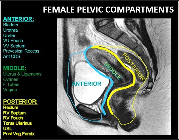Mri Female Pelvis Anatomy Free Mri Sagittal Cross
