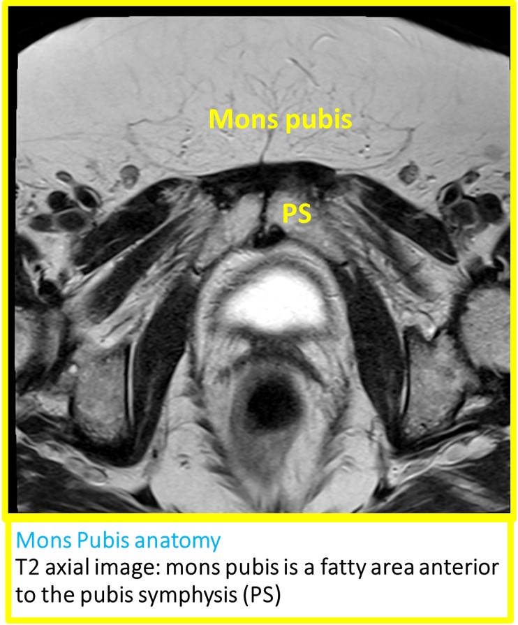 Mons Pubis Anatomy